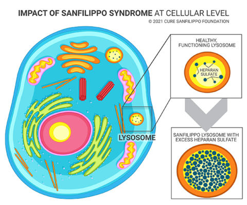 What Causes Sanfilippo Syndrome | Cure Sanfilippo Foundation